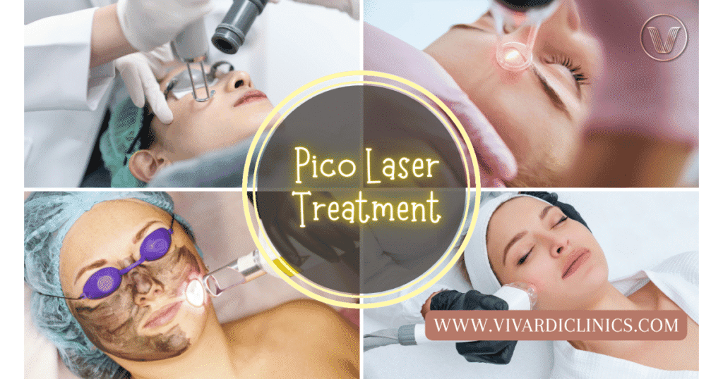How Pico Laser Treatment Helps Remove Pigmentation And Acne Scars